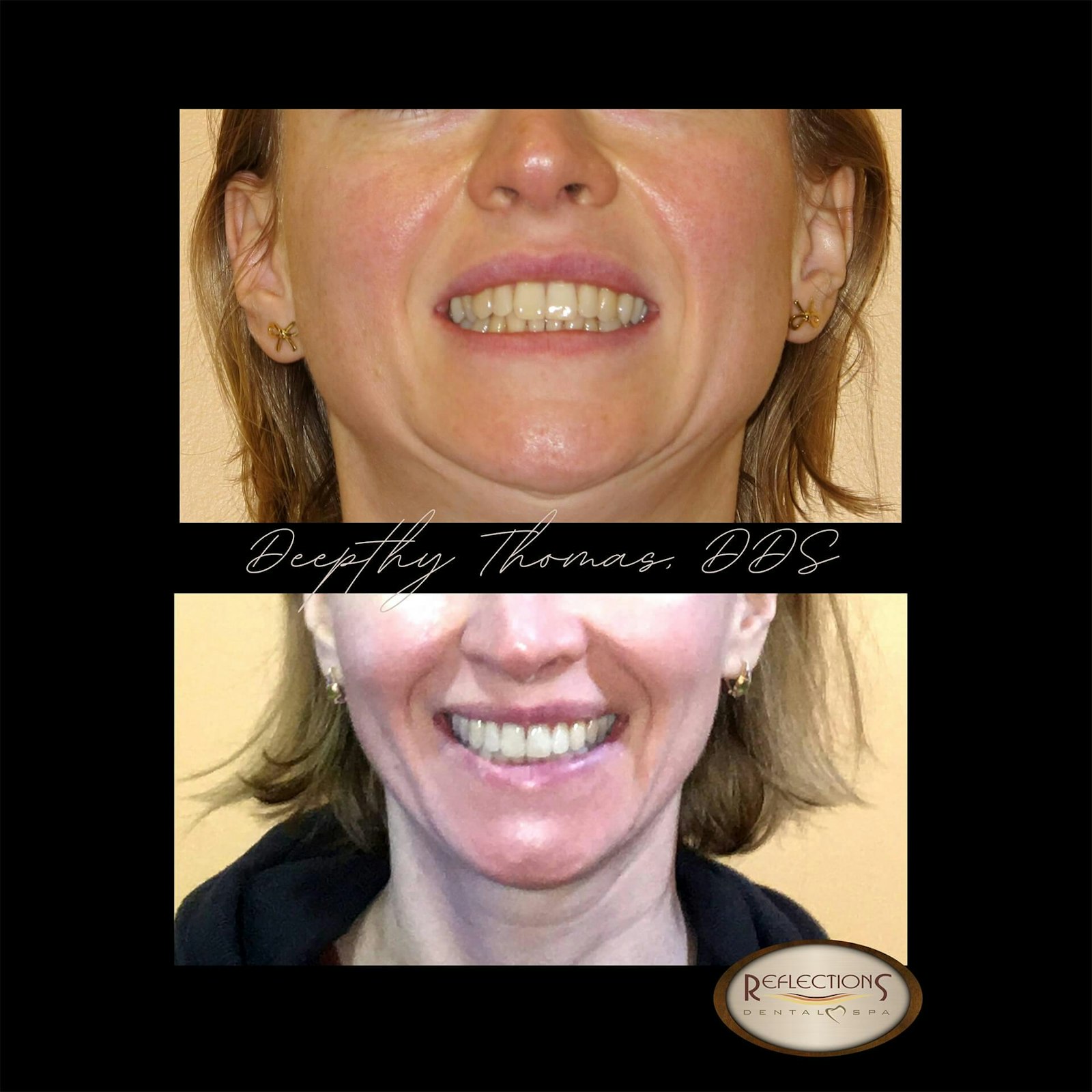 Reflections Dental Spa in San Ramon. Transforming Lives, One Smile at a ...